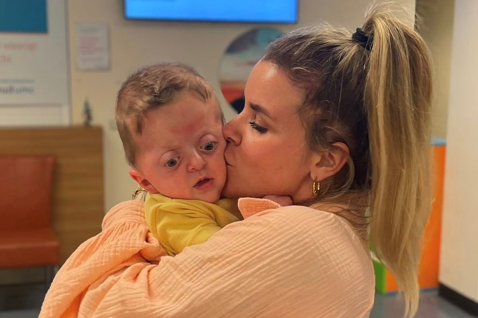 Lyo heeft het Apert syndroom: 'Wat is er met zijn handjes?'